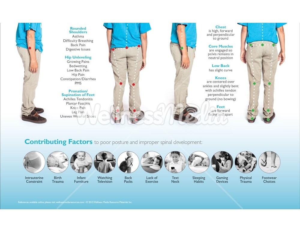 Chiropractic Perfect Posture Handout